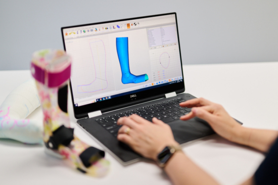 Paediatric prosthetic treatment – Momentum Therapy: Physio & Rehab